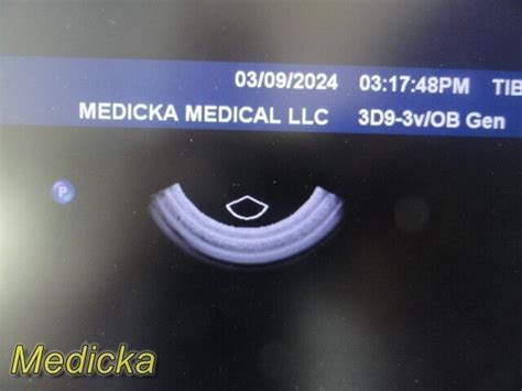 Used Philips 3d9 3v Convex Array 3d Endocavity Ultrasound Transducer