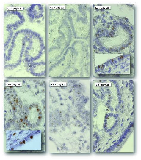 in situ hybridization analysis of complement component 7 c7 and