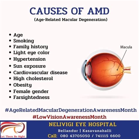 Ppt What Causes Amd Age Related Macular Degeneration Treatment In
