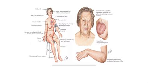 Thyroid Emergenciespptx