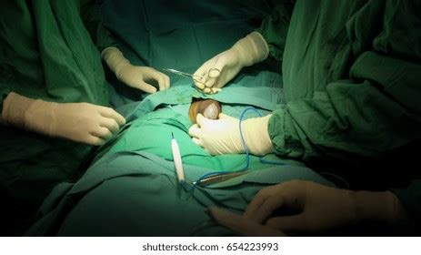 Torsion Testes Step By Step Surgery Stock Photo 654223993 Shutterstock
