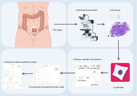 Pathomics Based Machine Learning Models For Predicting Pathological Complete Response And