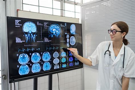 뇌 연구실에서 Mri Ct를 보여주는 모니터로 뇌 영상을 스캔하는 여성 의료진 뇌 프로젝트의 자기 공명 영상을 보여주는 유니폼을