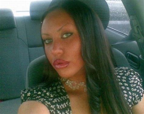 Girls With Silicone Faces 37 Pics
