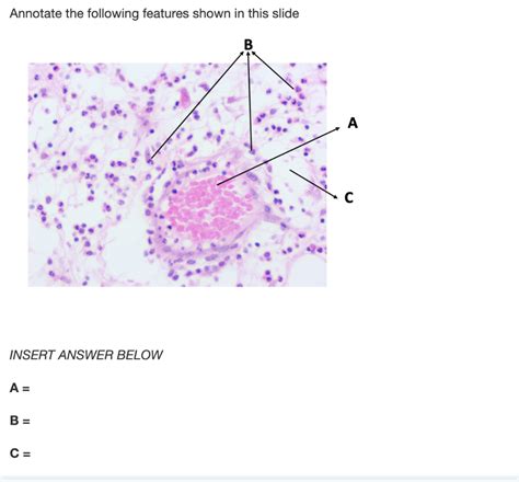 Solved Annotate The Following Features Shown In This Slide