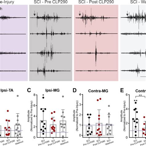 Clp290 Restores Flexor Inhibition In The Crossed Extensor Reflex A