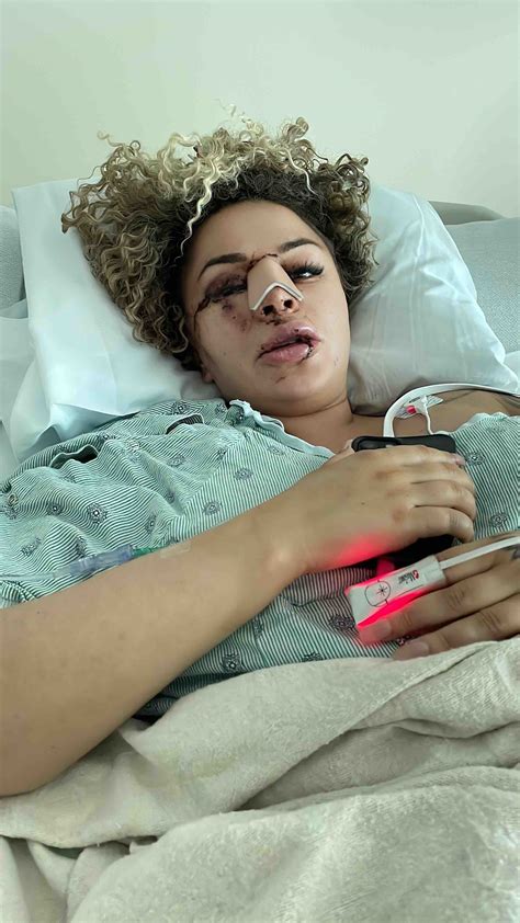 Fundraiser By Kateryna Melnyk Help Me Recover From A Critical Car
