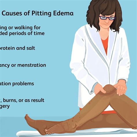 Dietary Salt Edema At Paul Brower Blog