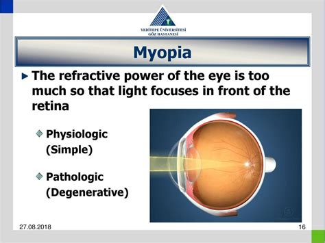 Refractive Errors Dr Canan Aslı UTİNE ppt download