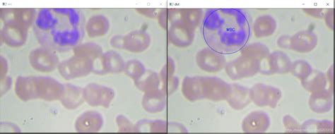 Tensorflow目标检测api实现血细胞图像识别和计数细胞图像检测识别 Csdn博客