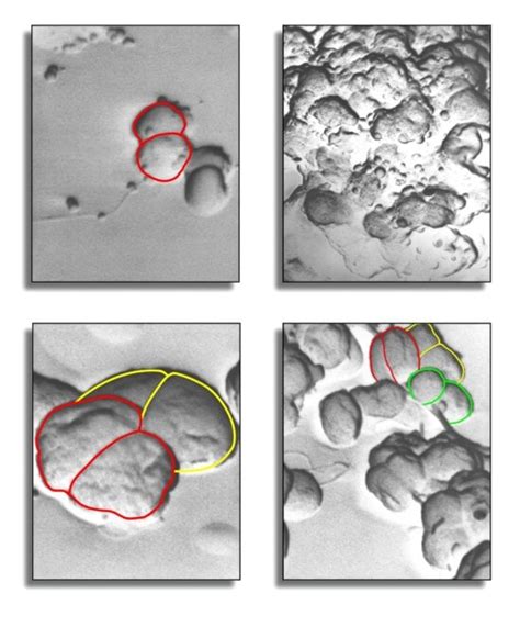 Image Libre Présence Gram Négatif Diplococcus Neisseria Gonorrhe