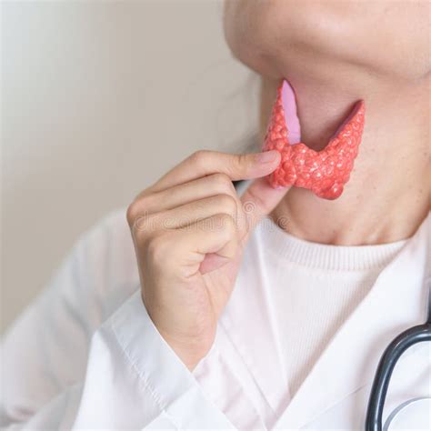 Doctor With Human Thyroid Anatomy Model Hyperthyroidism