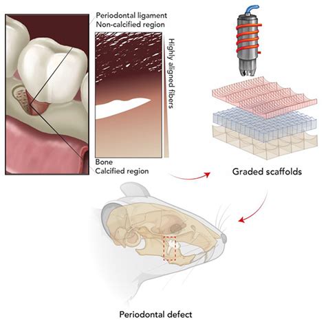 Composite Graded Melt Electrowritten Scaffolds For Regeneration Of The Periodontal Ligament To