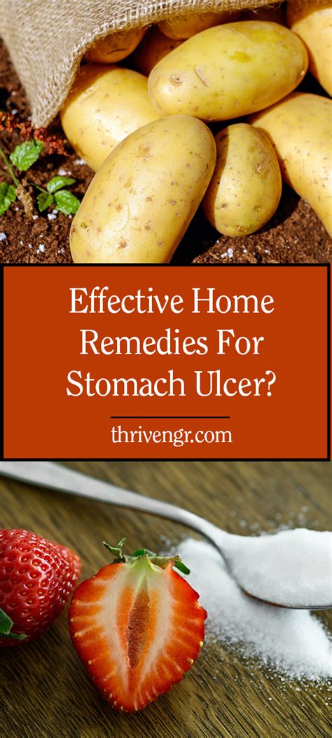 Stomach Ulcer Home Remedies For Stomach Ulcers Treat