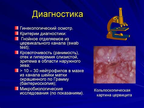 Воспалительные заболевания женских половых органов презентация онлайн