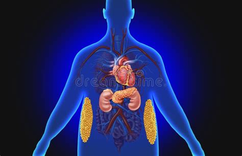 Multisystem Disorder Stock Illustration Illustration Of Endocrinology