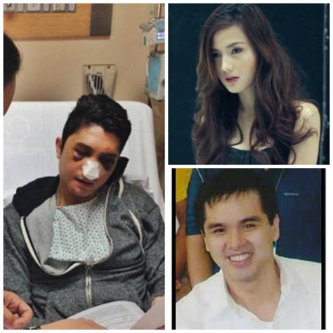 Vhong Navarro And Deniece Cornejo Sex Scandal Page 2 Filipino Love Team