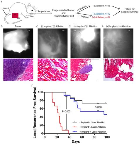 A Fluorescence Guided Laser Ablation System For Removal Of Residual Cancer In A Mouse Model Of