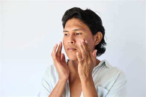 How Your Face Can Indicate Fatty Liver Disease