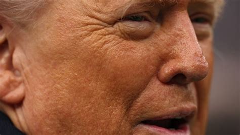 Extreme Close Up Pics Of Donald Trump Are Shocking