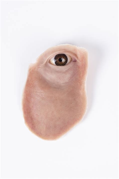 Maxillofacial Prosthetics