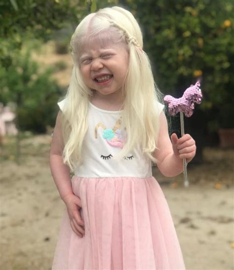 Une Fille Albinos Est Née Dans Une Famille Mexicaine Aujourdhui