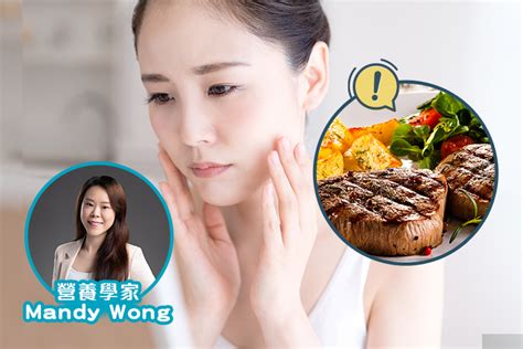 預防衰老｜糖化終產物令皮膚加速衰老 3種食物含抗氧化物抑制自由基 內服外敷nmn助改善肌膚老化暗啞