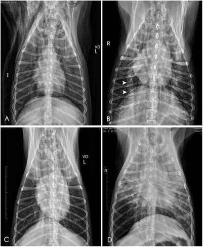 Full Article Thoracic Radiographic Features Of Fatal Paraquat
