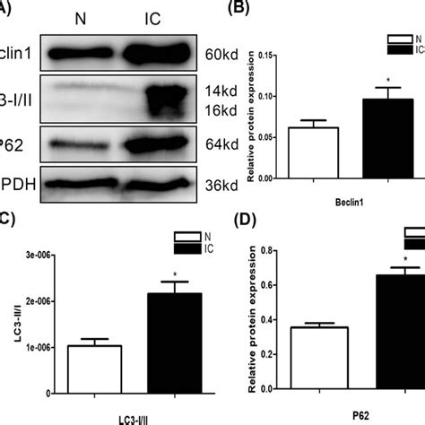 Expression Of Autophagy And Autophagic Flux Factors In The Urinary