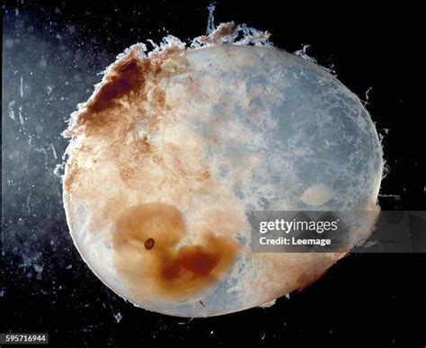 Embryo Sac Photos And Premium High Res Pictures Getty Images
