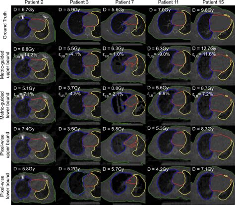 Figure 1 From Metric Guided Image Reconstruction Bounds Via Conformal Prediction Semantic Scholar