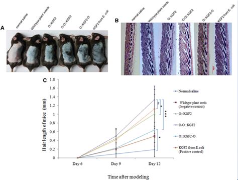 Male Body Hair Stages
