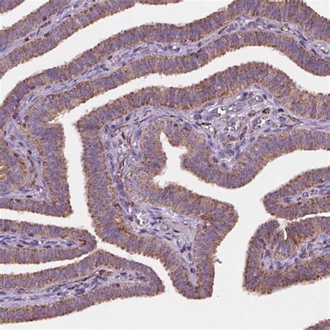 Gemin 4 Polyclonal Antibody Invitrogen 100 μl Unconjugatedantibodies