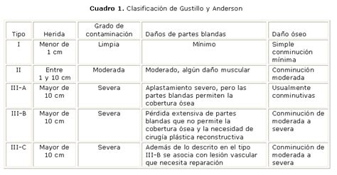 Tratamiento De Las Fracturas Abiertas De La Diáfisis Tibial