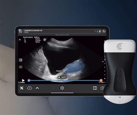 Fda Clears Ai Powered Prostate Volume Measurement For Handheld Ultrasound
