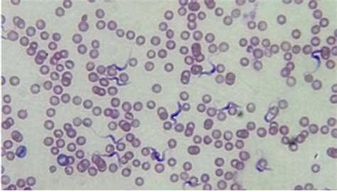 Quiz 2 Protists Flashcards Quizlet