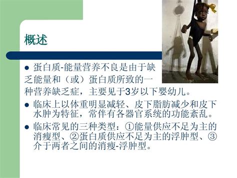 蛋白质 能量营养不良 word文档在线阅读与下载 免费文档