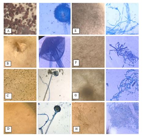 Isolation And Identification Of Endophytic Fungi From Leaves And Stem