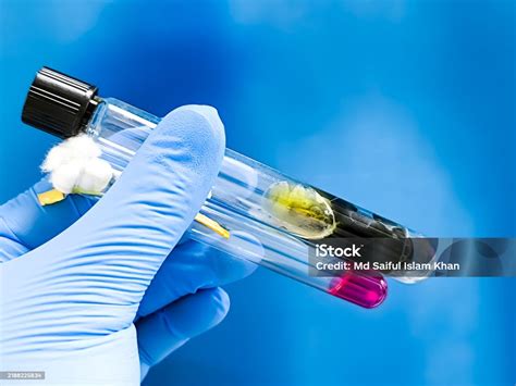 Physical Examination By Tsi Agar And Miu Agar In Microbiology