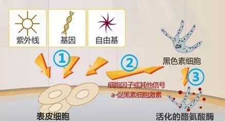 黑色素形成的原因，我们都要了解！