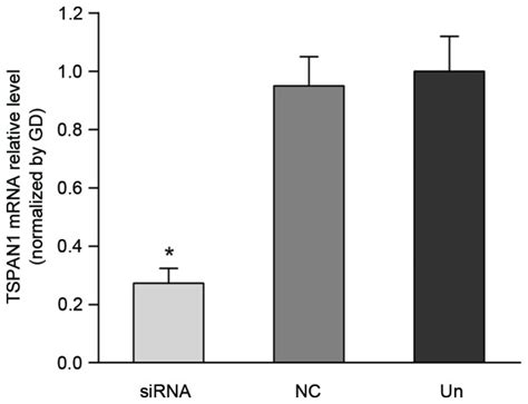 Expression And Function Of Tetraspanin 1 In Esophageal Carcinoma Pmc