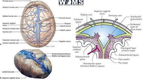 Anatomical Relationship Of The Superior Sagittal Sinus With Sagittal Midline Woms