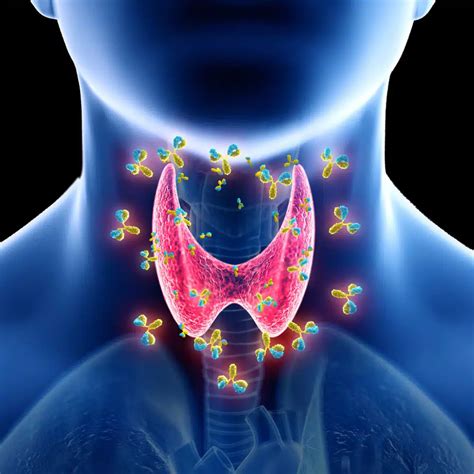 Thyroid Troubles Strategies For Managing Thyroid Disorders