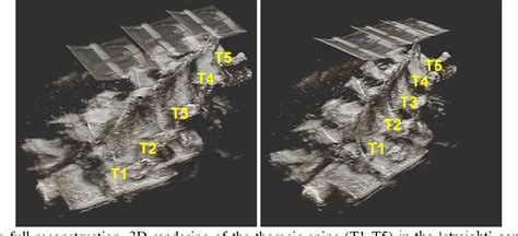 Figure 1 From Assessment Of Spinal Curvatures In Static Postures Using Assessment Of Spinal