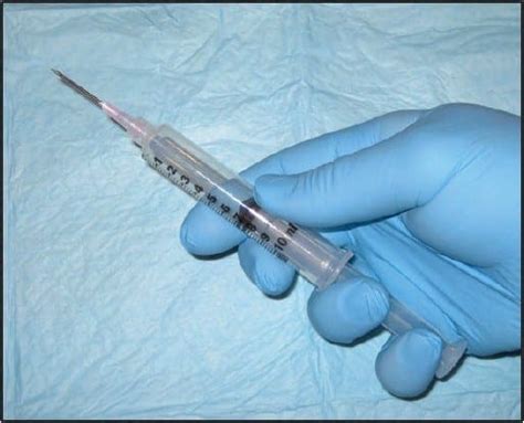 Biopsy Planning And Post Biopsy Tissue Handling A Synopsis Bako