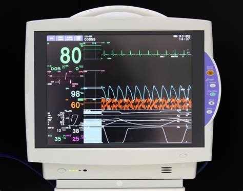 What Is An Ecg Amplifier With Pictures