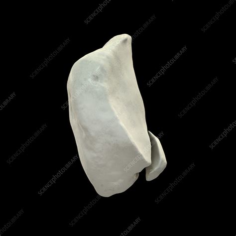 Patella Osteochondral Fracture Illustration Stock Image F044 2828