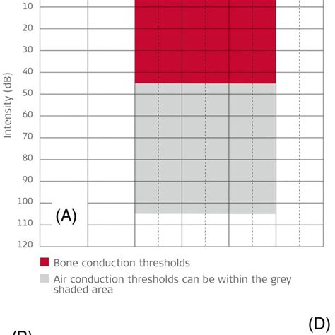 Audiogram Shows The Companys Recommended Audiological Indication Range Download Scientific