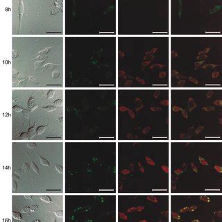Subcellular Localization Of NS And 2 Proteins In Cells Infected With