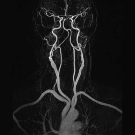 Upper Limb Radiology Key